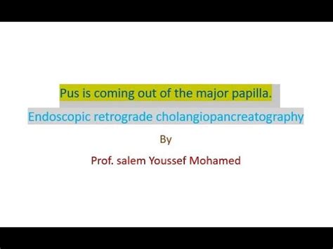 Acute Cholangitis Liver Abscess Salem Yousef