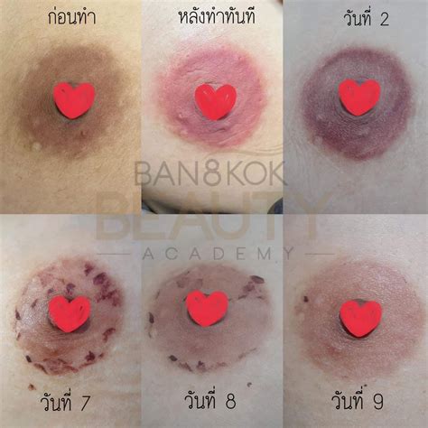 Areola1 Bangkok Beauty Academy No1 Microblading In Thailand