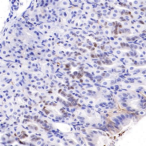 S Rmab® C Myc Recombinant Rabbit Mab Sdt R138p01106starter Bio