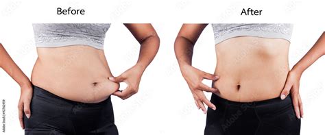 Belly Fat Before And After