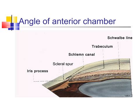 Pupil Block Glaucoma Ppt