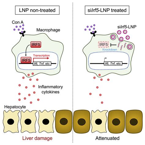 Irf5 Sirna Loaded Biodegradable Lipid Nanoparticles Ameliorate Concanavalin A Induced Liver