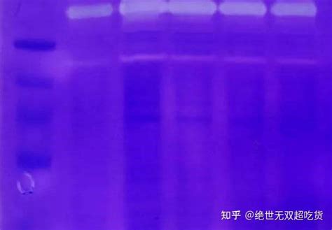 【实验方法】明胶酶谱法检测 Mmp 活性 知乎