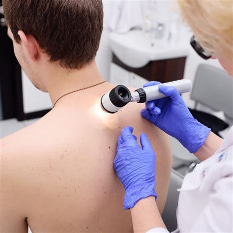 Treating Cutaneous T Cell Lymphoma Innovative Therapies And