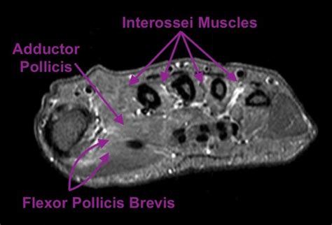 Guyons Canal Radsource