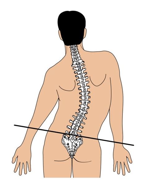 Cnaturals Did You Know That Misalignment Of The Pelvis Is A Common