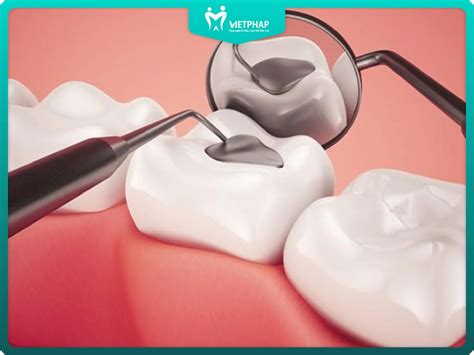 Dense Là Gì Giải Nghĩa Ví Dụ Câu Và Cách Sử Dụng Dense Trong Tiếng Anh