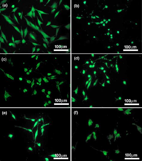 Merged Microphotographs Of Human Chondrocyte Cell Line Chon 001