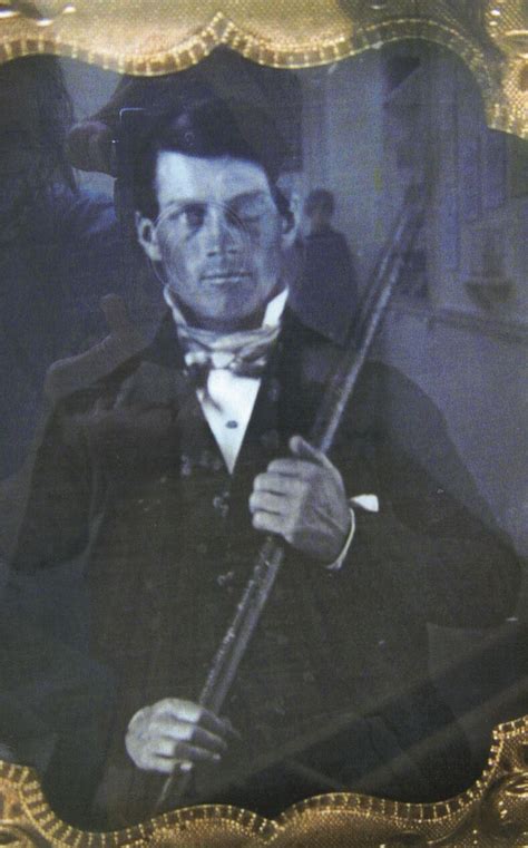 Meet” Phineas Gage At The Saint Albans Museum Local News