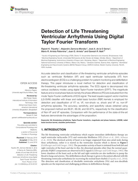 Pdf Detection Of Life Threatening Ventricular Arrhythmia Using
