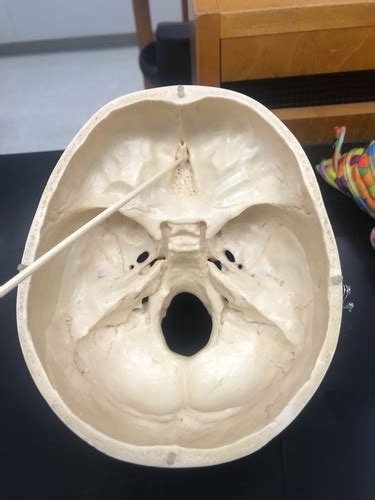 The Axial Skeleton Ethnoid Bone Flashcards Quizlet