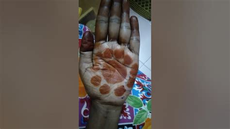 After Removing Goritaku Youtube