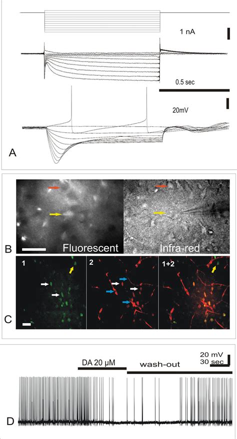 A Whole Cell Patch Clamp Recording From Fluorescent Cells After Slice
