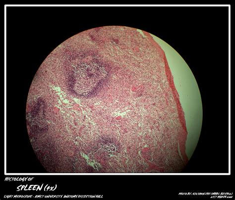 Histology Spleen My Aimst University Lifestyle Blog