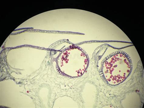 Lycopodium Strobilus Under Microscope