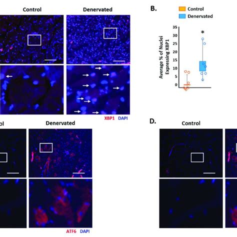 Effect Of Sciatic Nerve Transection On Neuromuscular Junction Nmj Download Scientific Diagram