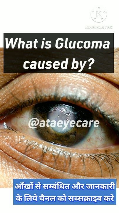What Is Glucoma Caused By Ataeyecare Viralvideos Ytshort Glucoma Intraocularpressure Youtube