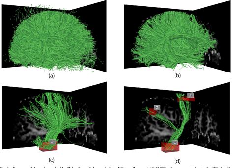 Figure 3 From Ieee Transactions On Visualization And Computer Graphics 1 Exploring Connectivity
