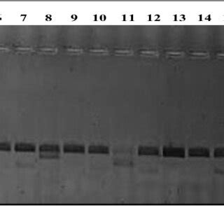 Agarose Gel Electrophoresis Shows Bands Of The Whole Genomic Dna