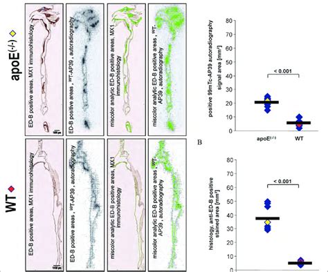 Representative Aortic Tissue Sections And Analyses 99m Download