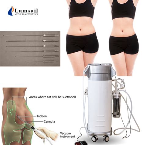 Sistema De Liposucción Quirúrgica Conjunto De Cánulas De Liposucción