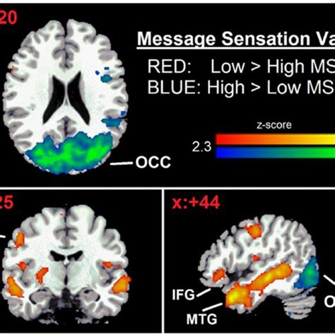 Brain Response To Safe Sex Video Messages Middle Temporal Gyrus Mtg