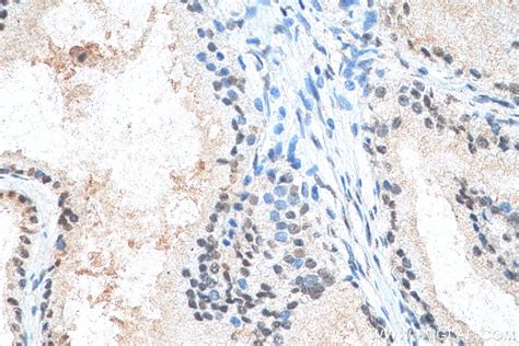 Ncor2 Antibody 29952 1 Ap Proteintech