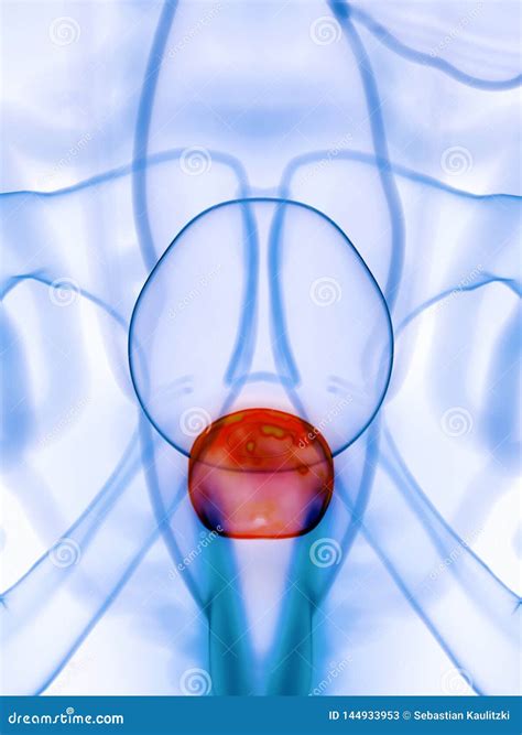An Inflamed Prostate Royalty Free Cartoon 144933953