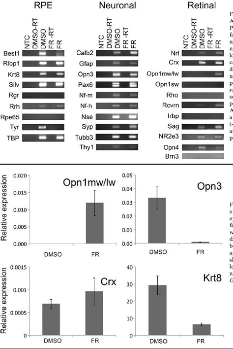 Figure 2 From The Expression Of Retinal Cell Markers In Human Retinal