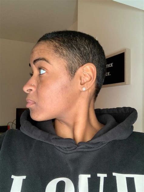 Hyperpigmentationsun And Age Spots Mary Scott Skincare®️