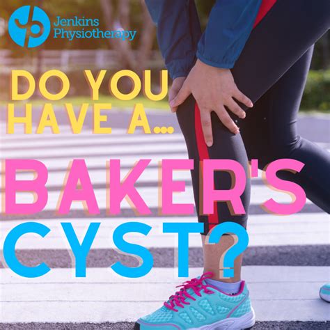 Bakers Cyst Treatment Perth Jenkins Physio