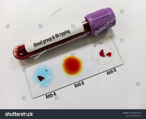 Slide Agglutination Test Procedure