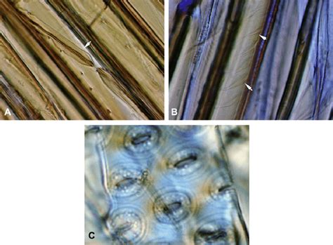 Microbial Decay In Non Acetylated Poplar A Soft Rot Decay Arrow