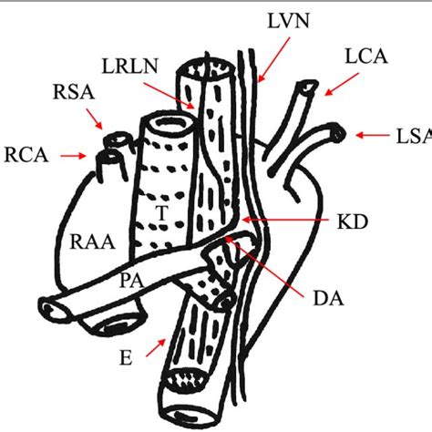 Schematic Illustration Of The Mediastinal Structure Of The Present