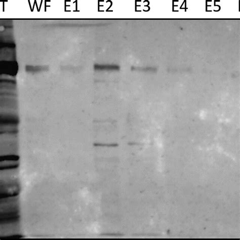 Western Blot Analysis Of Protein Extracts And Elution Fractions After