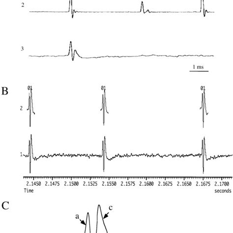 Waveform Classification And Incidence Of Individual Waveform Types As