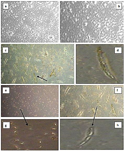 Growth Of Cd34 Positive Cd34 Cells Hematopoietic Stem Cells