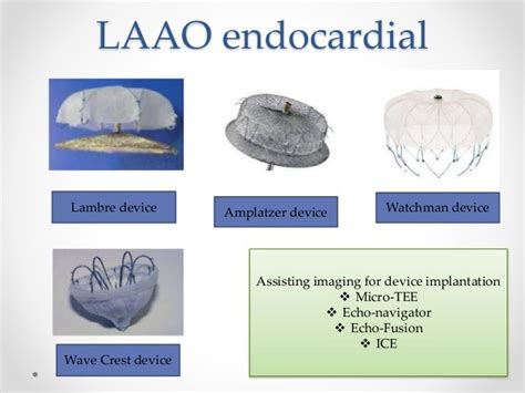 Innovations In Atrial Fibrillation Management
