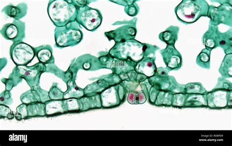 Angiosperm Morphology Peltate Trichome In Abaxial Epidermis Of Ligustrum 36198189074 Stock