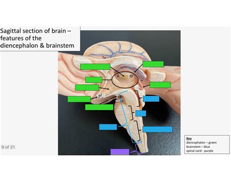 Sagittal Diencephalon And Brainstem Quiz