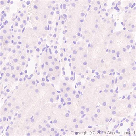 Anti Trypsin Antibody Epr29805 7 Ab325233 Abcam中文官网