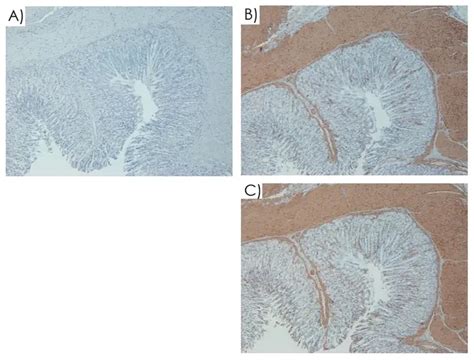 Mouse On Mouse Polymer Ihc试剂盒 Ab269452 Abcam中文官网