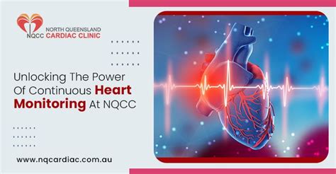 Unlocking The Power Of Continuous Heart Monitoring At Nqcc North Queensland Cardiac Clinic