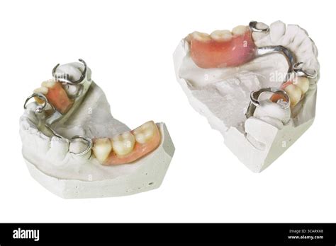 Plaster Cast Of Teeth And Dentures Which Is Made In This Mold Isolated