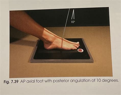 Foot Ap Or Ap Axial Projection Flashcards Quizlet