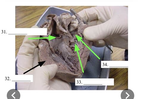 Anatomy Heart 2 Diagram Quizlet
