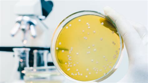 How To Make Competent Cells Protocols And Tips Zymo Research