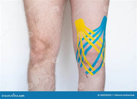 Knee Taping After Knee Surgery And Meniscus Replacement Rehabilitation