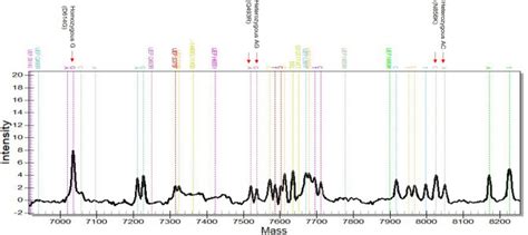 Simultaneous Detection Of Omicron And Other Sars Cov 2 Variants By