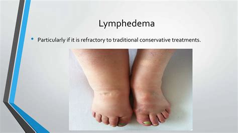 Lipectomy Procedure In Burns Treatment Regimen Ppt